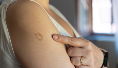 A descoberta da vacina contra a varíola: Edward Jenner e o início da ...